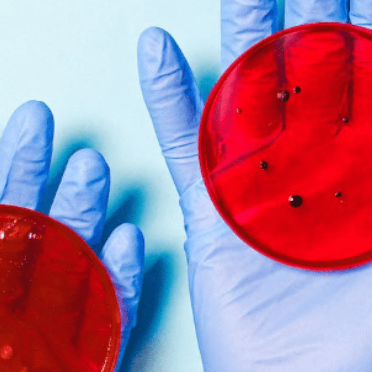 What are the different types of vaginal infections?